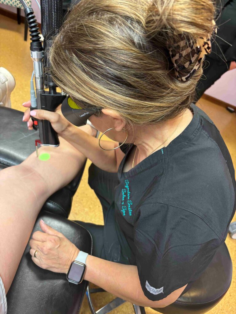 AlloraPro Hair Removal Laser | Chameleon Spa | Fayetteville